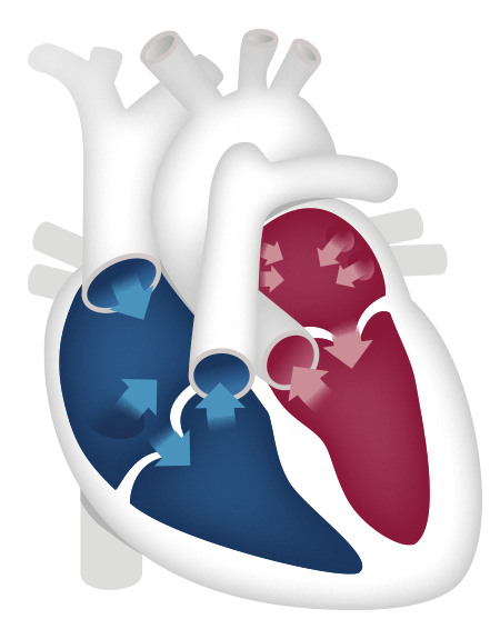 What Is PAH? | Medical Abbreviation